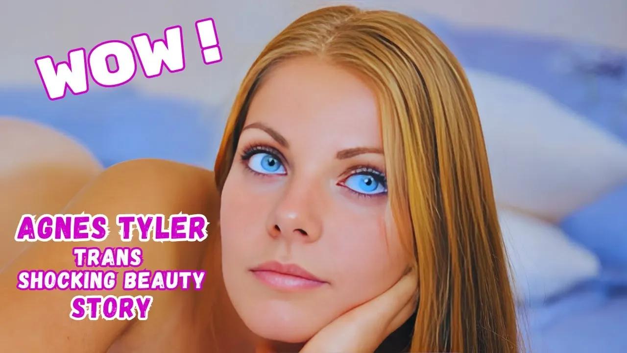 Agnes Taylor - Shocking Trans Beauty Story