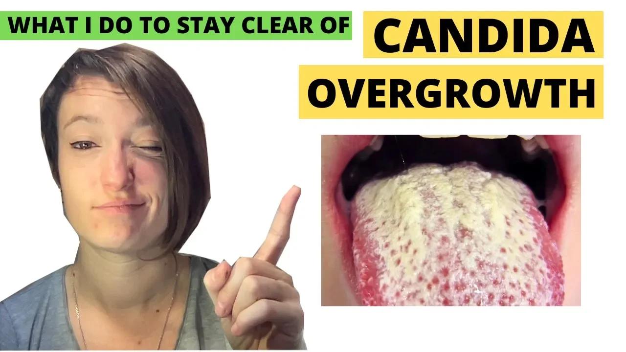 8 things I do to never get candida overgrowth ever again