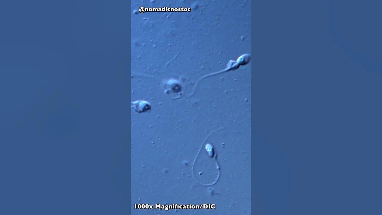 Human Sperm under the Microscope #shorts
