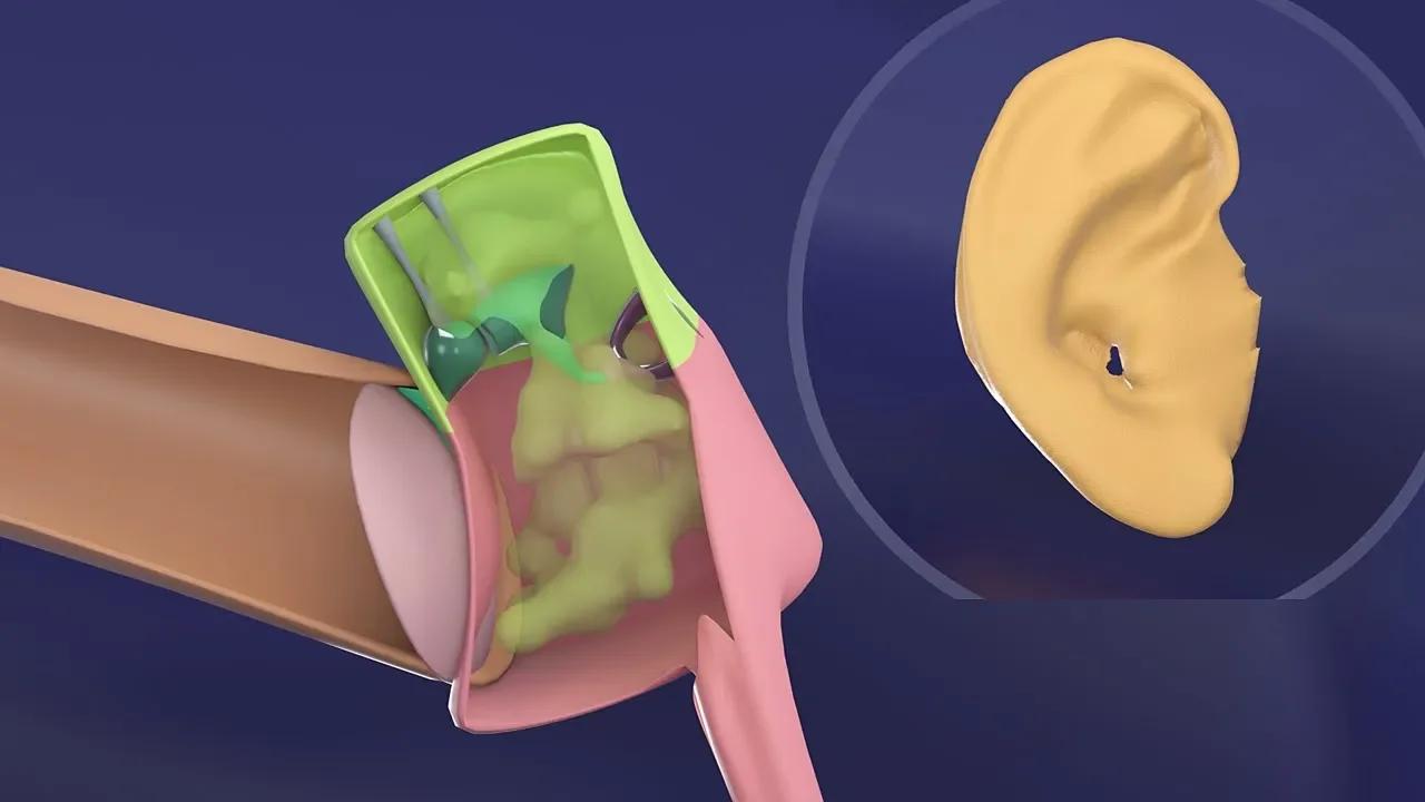 3D Middle Ear & External Ear embryology - Impedance matching - Ossicles Embryology