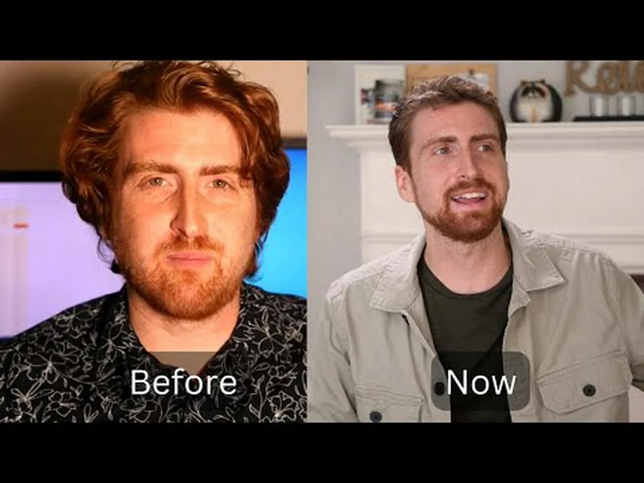 I Relapsed Publicly Then Found Recovery from Addiction