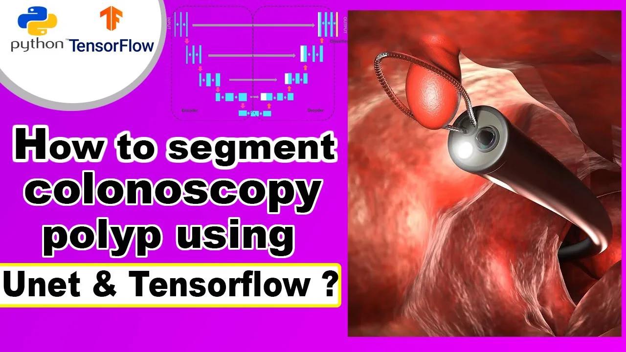 Medical Polyp Image Segmentation with U-Net and TensorFlow Keras