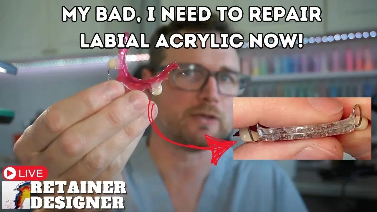 How to Repair Labial Acrylic
