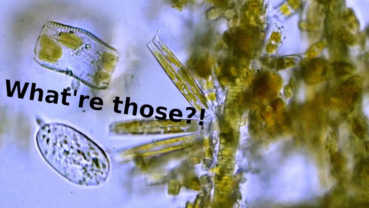 Sea algae biofilm under the microscope (cilliates, plankton, etc)