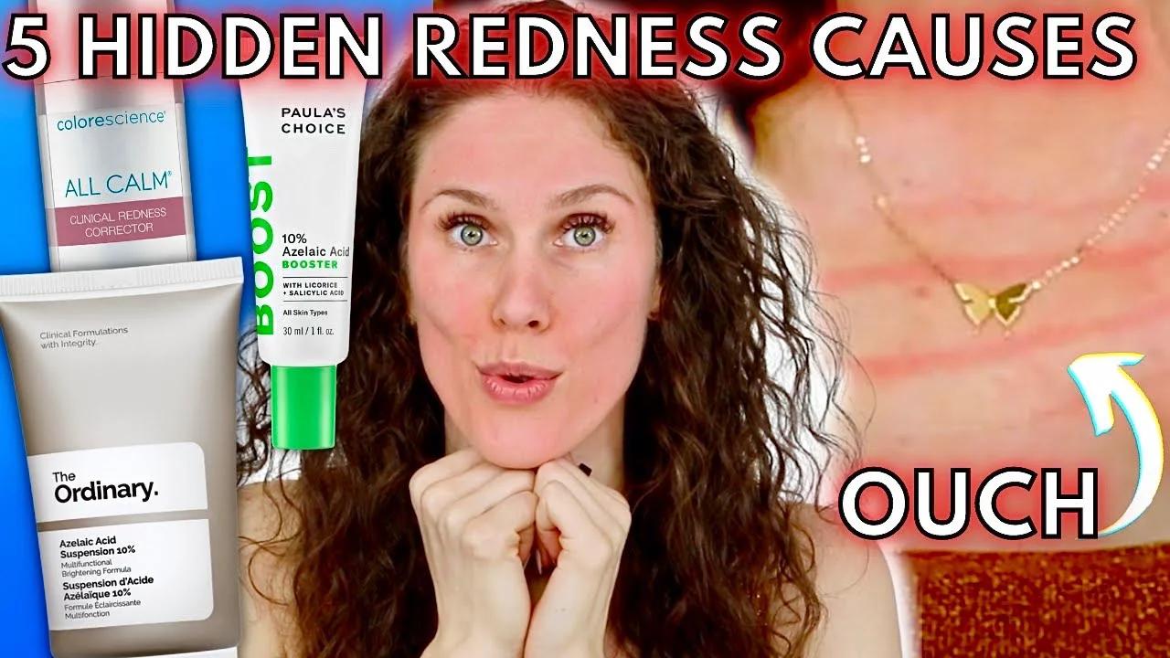 🔴 5 Reasons Your Face Is Always Red (Rosacea to Dermatographia ...