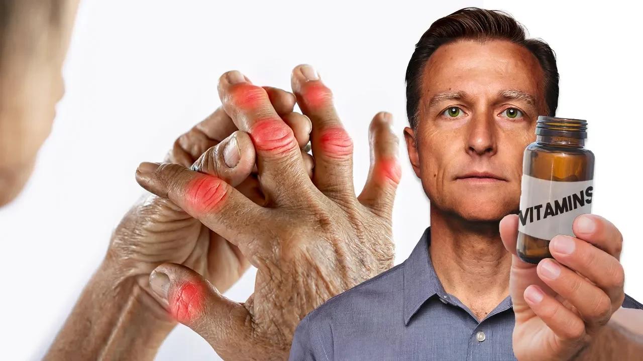 The 1 Best Vitamin For Arthritis Not Vitamin D