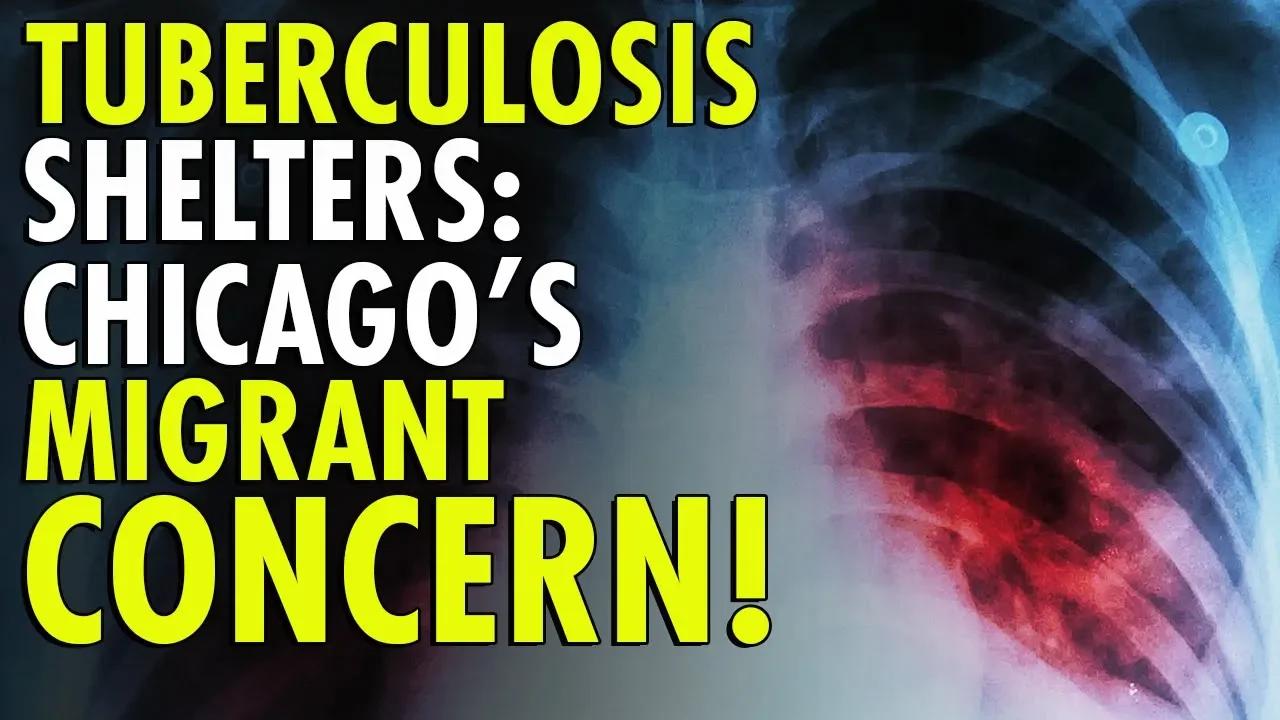 "Small Number" of Tuberculosis Cases in Chicago's Migrant Shelters ...