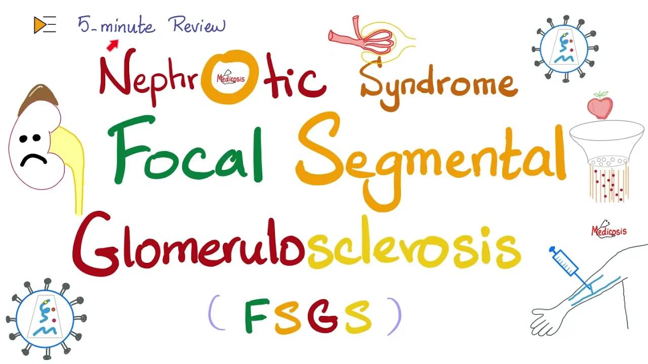 Focal Segmental Glomerulosclerosis (FSGS) | Nephrotic Syndrome | 5 ...