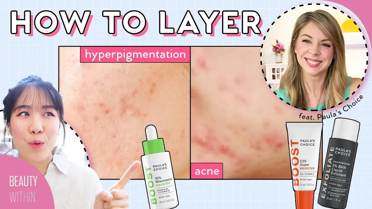 How to Reduce Acne, Hyperpigmentation & Fine Lines /Wrinkles ft. Paula ...