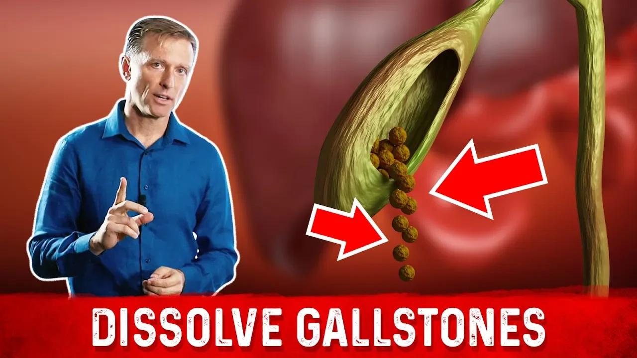 Do This to Help Dissolve Gallstones