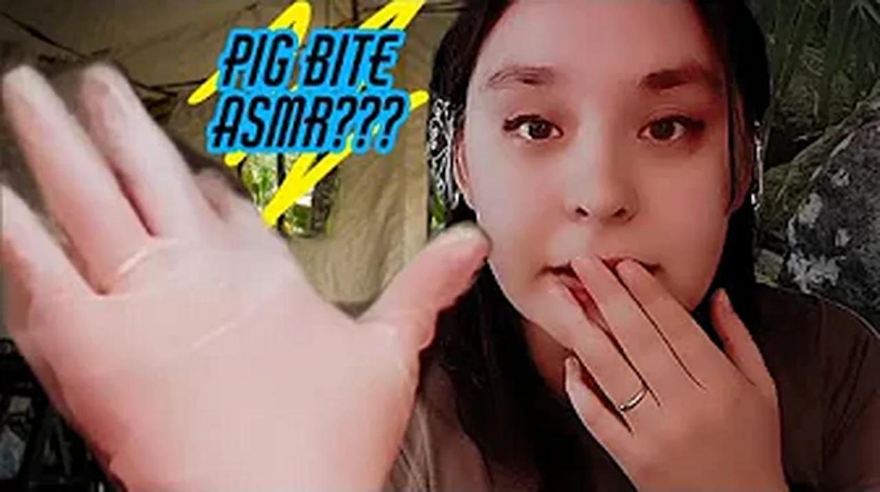 Doctor treats your PIG BITE - ASMR Wilderness Medical Exam (real physician, gloves, soft spoken)