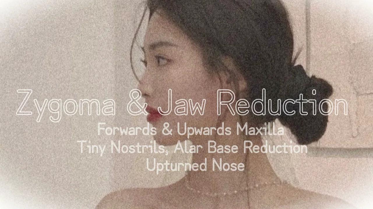 Zygoma & Jawline Reduction Calm Version *Paid Request*