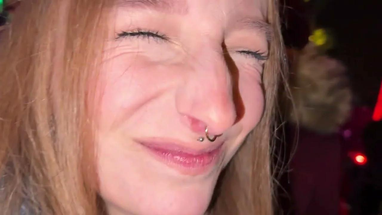tollwut