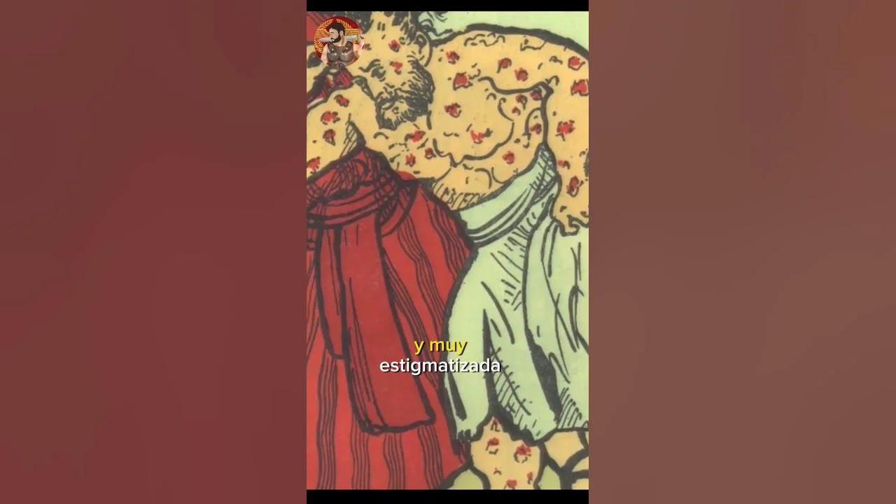 Los síntomas de la Lepra en #Balduino IV y sus comienzos como #rey # ...