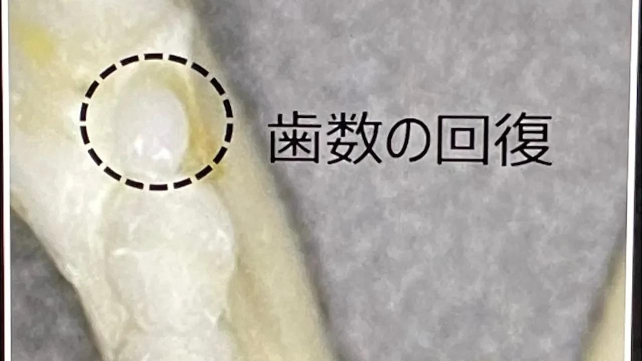 How to regrow teeth? New technology from Japan?