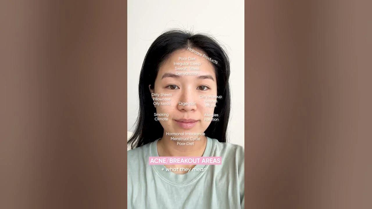 What your breakouts are telling you!! 📢💢 A GUIDE