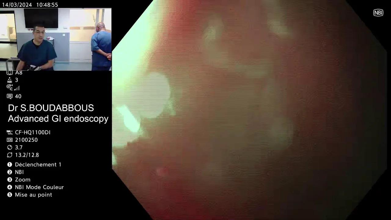screening endoscopy
