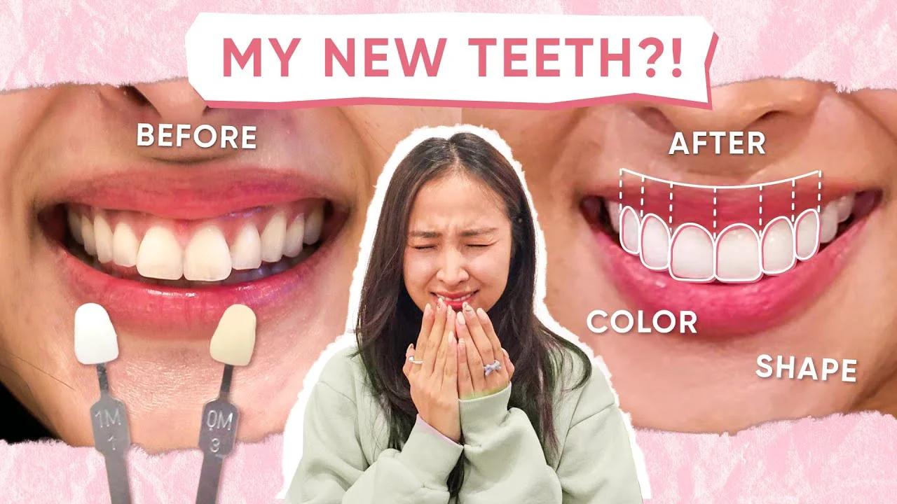 I got the “PERFECT” teeth treatment in KOREA 🦷😬 *what you NEED to know*