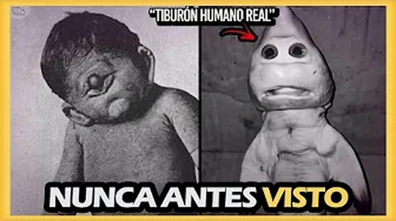 Baby Shark En La Vida Real: Descubren Tiburón Con Cara De Humano Nunca ...