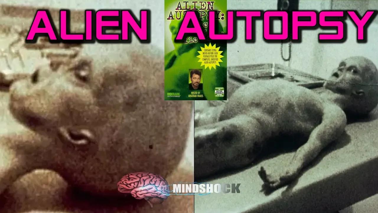 ROSWELL - THE ALIEN AUTOPSY (MINDSHOCK ALIENS, UFOs, and CONSPIRACY ...