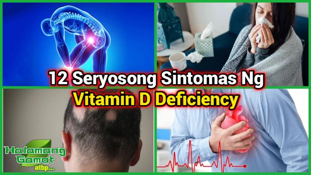 12 Seryosong Sintomas Ng Vitamin D Deficiency | Halamang Gamot ATBP