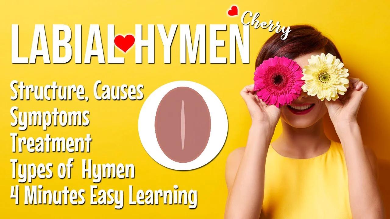 Labial Hymen Rare types of hymen, Structure, Symptoms, Diagnosis ...