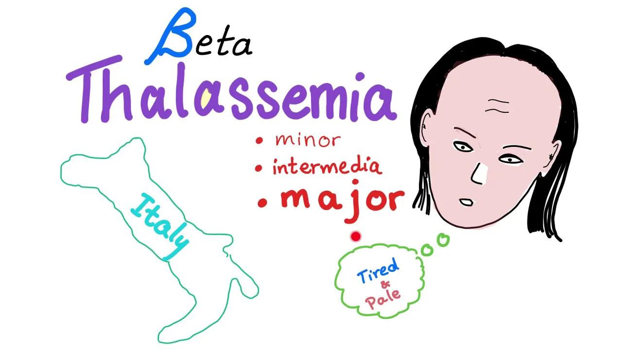 Beta Thalassemia; Causes and Types (minor, major and intermedia)