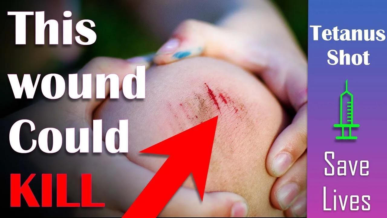 What is Tetanus ? [Tetanus Disease] | Complete Information
