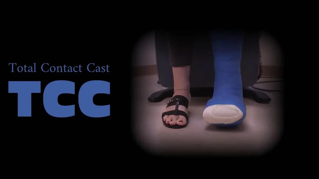 TCC - Total Contact Cast - Application & Walking with it