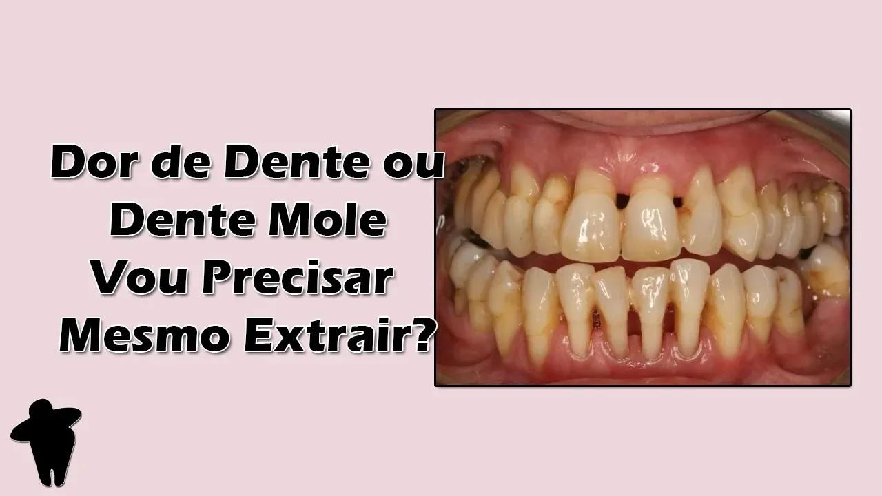 Está Com Dor de Dente ou Dentes Moles? - Calma, Você Não Vai Precisar ...
