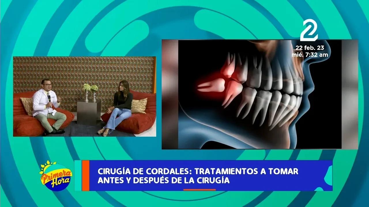 Cirugía de Cordales: tratamiento