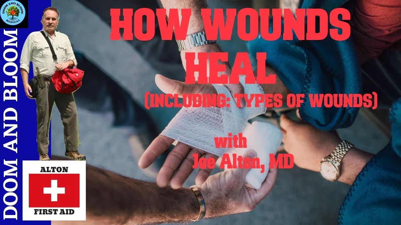 How Wounds Heal and Types of Injuries with Dr. Joseph Alton