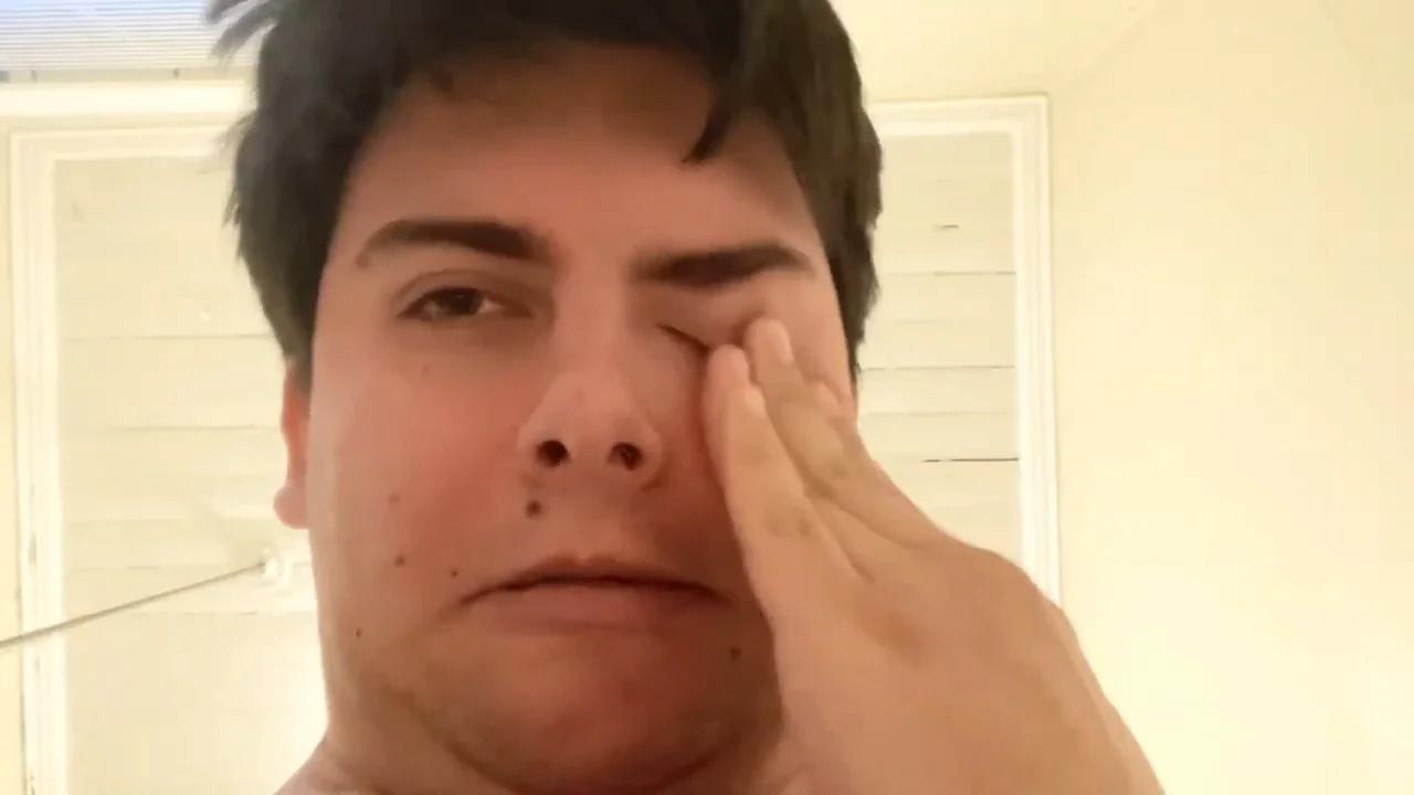 AMAZING! Man HEALS missing EYE with the POWER OF LOVE!!!! [The Laughing ...