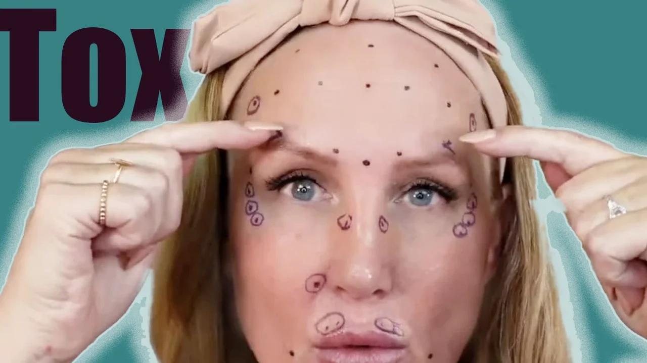 Full Face Botox Mapping - Mistakes to Avoid