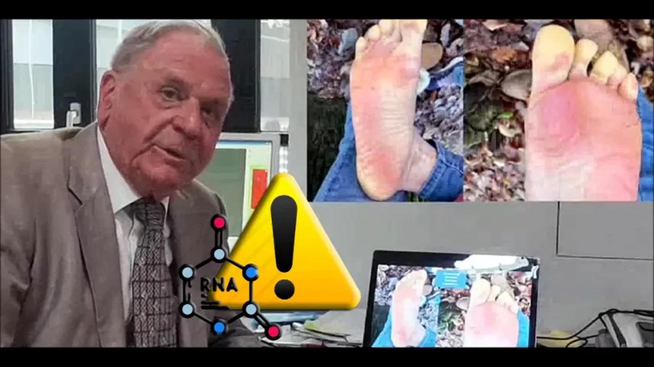 PROF. DR. ARNE BURKHARDT - Die Zeitbombe
