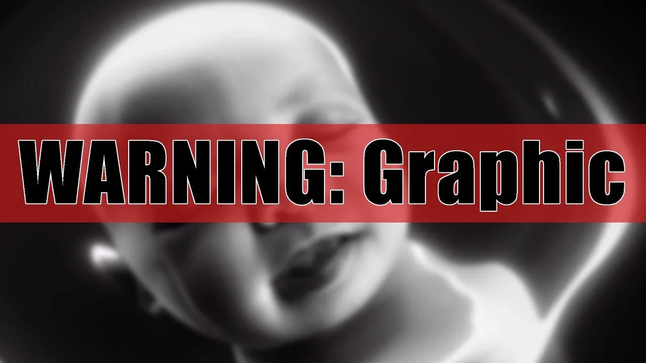 The Procedure — WARNING: Graphic Disturbing