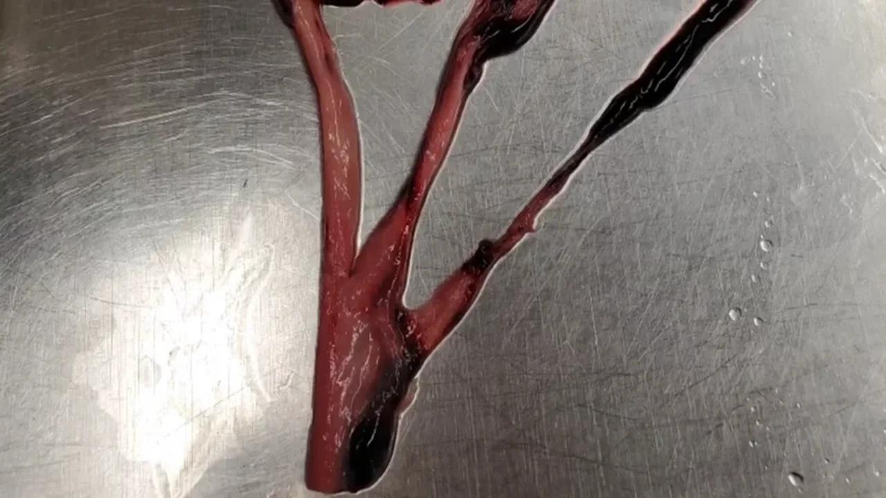 Died Suddenly full documentary