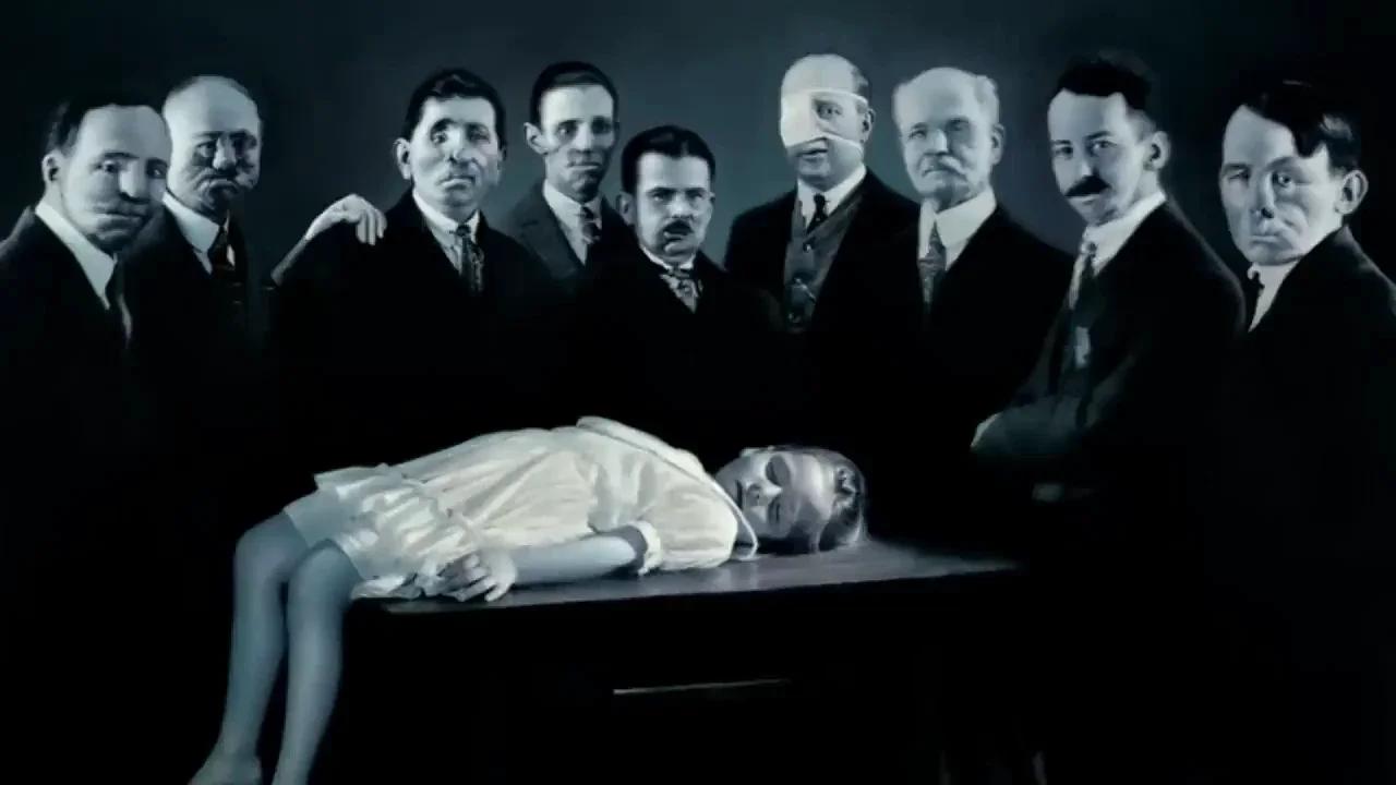 Parabiose Hétérochronique - L'adrénochrone - Peter Thiel