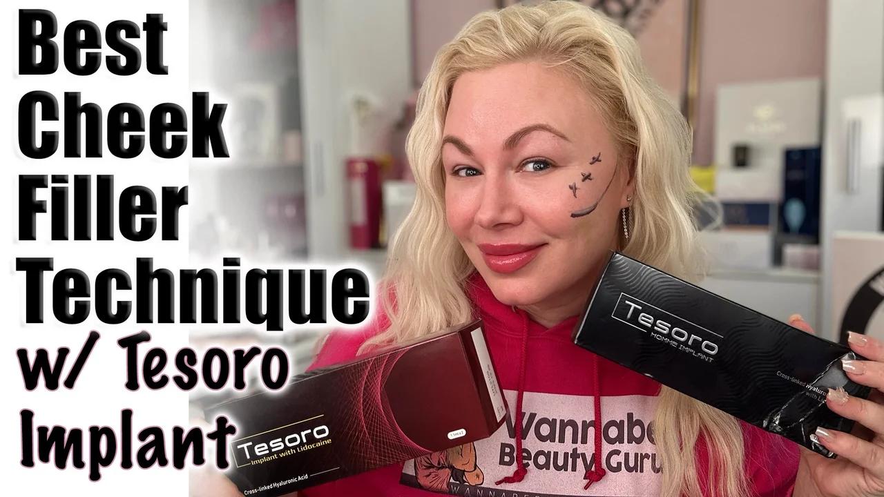 The BEST Cheek HA Filler Technique and Mapping! Code Jessica10 Saves ...