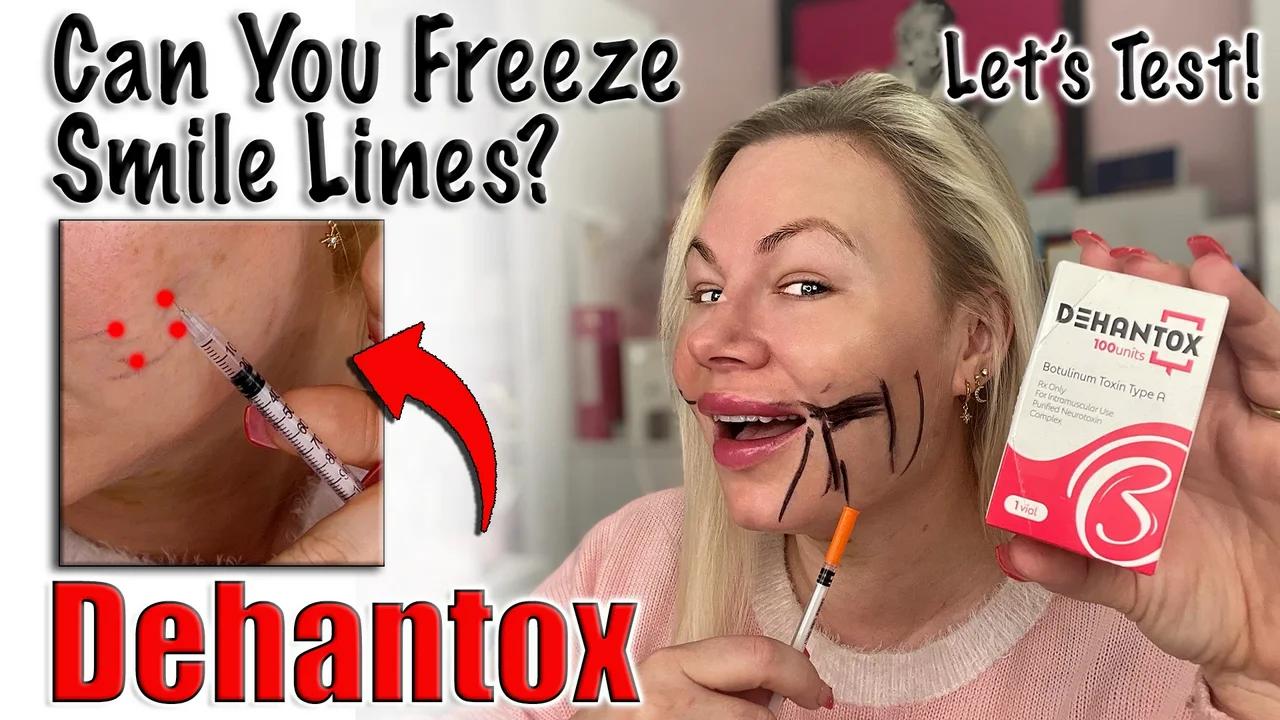 Can You Freeze your Smile Lines with Tox? Let's Test with Dehantox ...