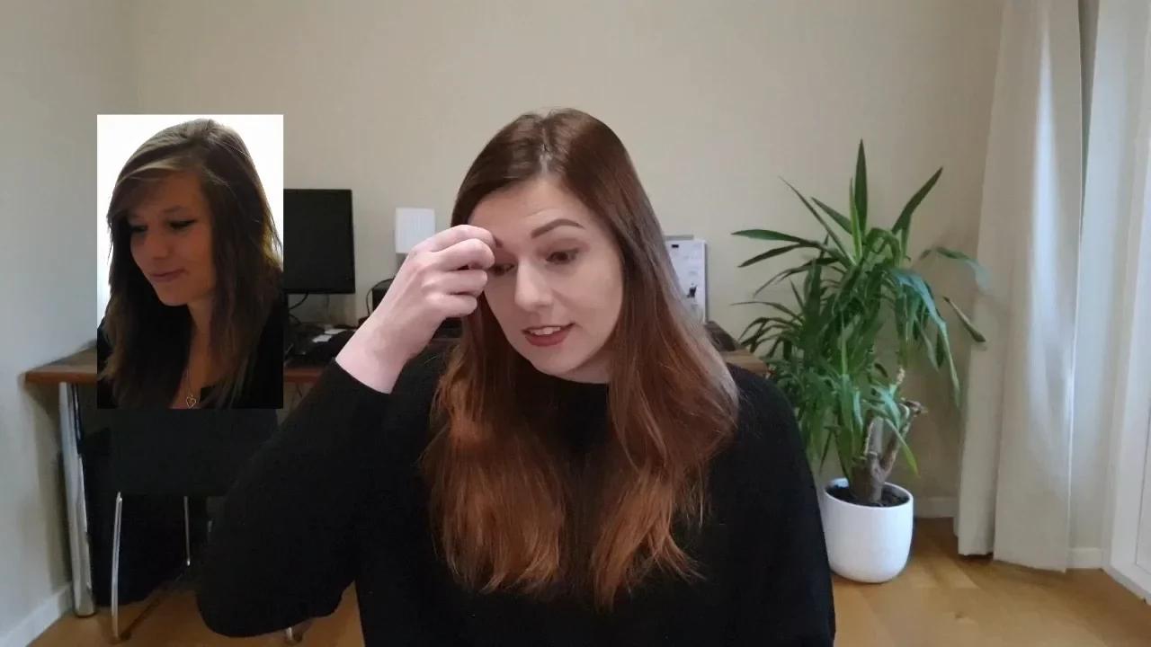 My Jaw Surgery Fixing Overbite