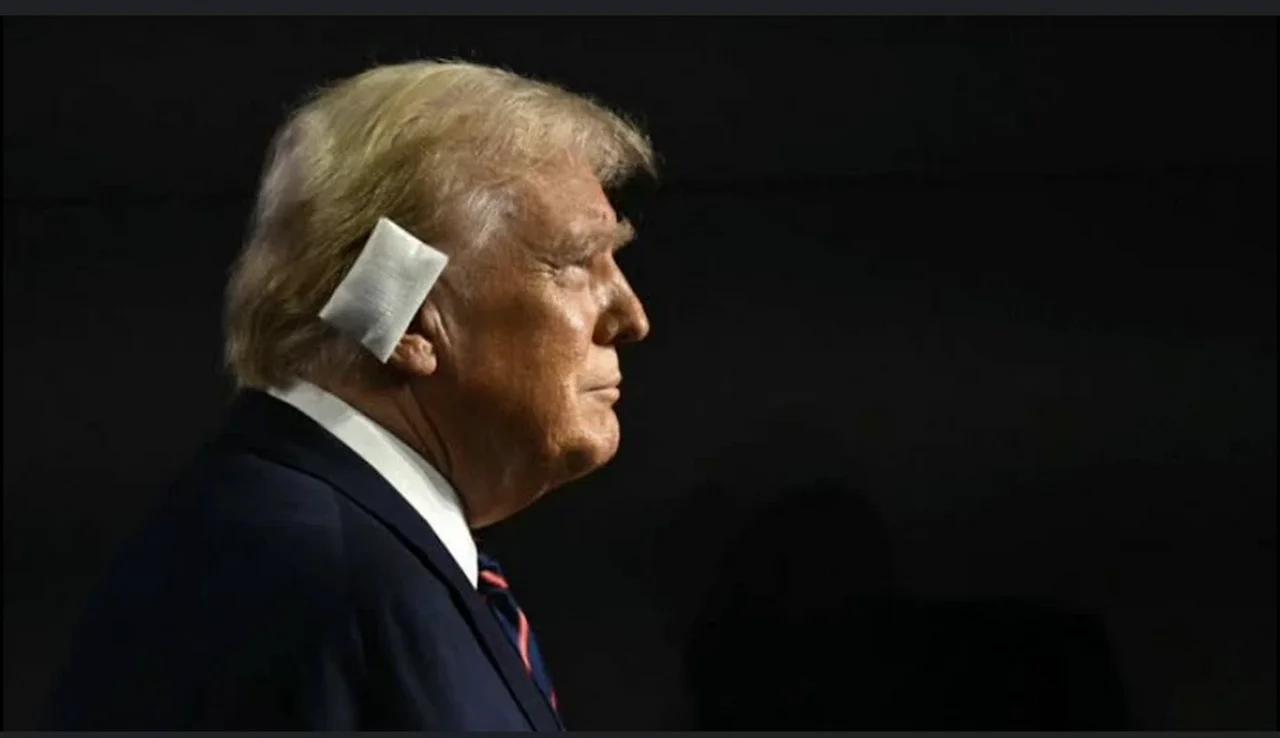 Trumps ear