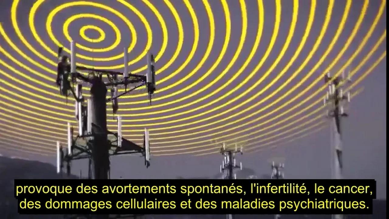 Les effets des ondes 5G et Wi-fi sur le corps humain