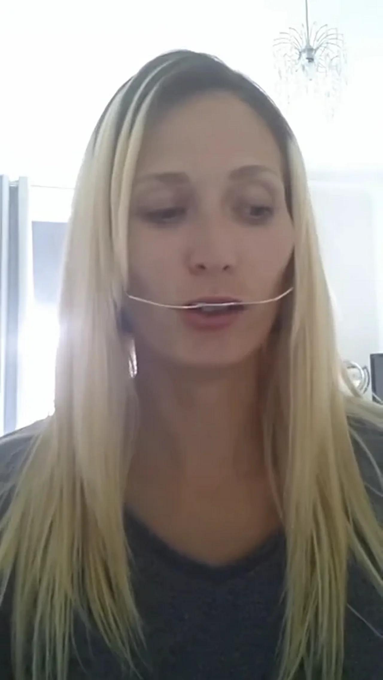 Adult Braces And Headgear