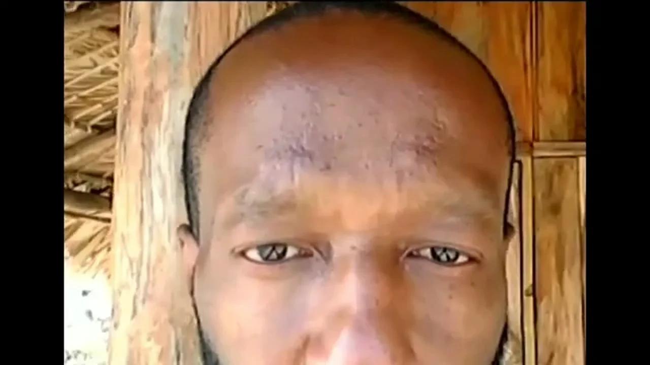 Reptilian Ancestral Eye-