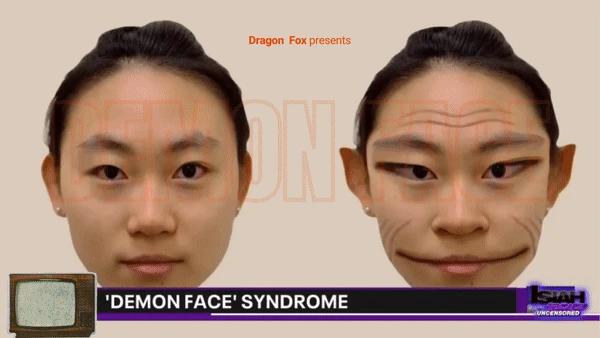 Demon Face Syndrome