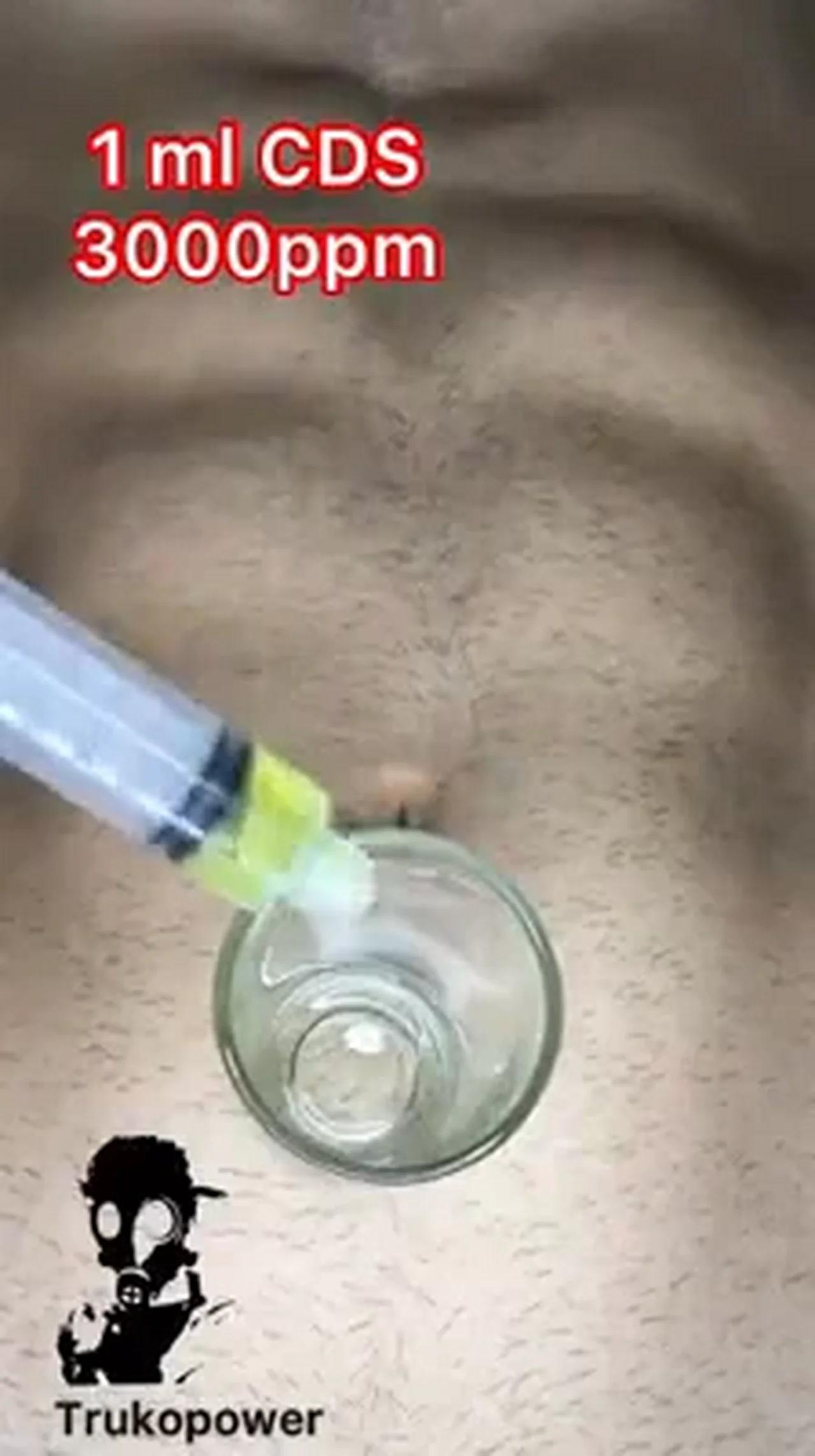 Protocolo Torunda en el Ombligo