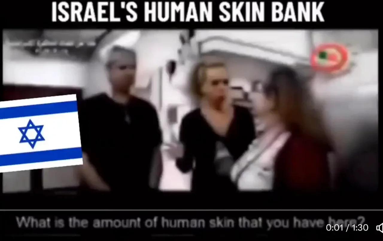 Israels Human Skin Bank