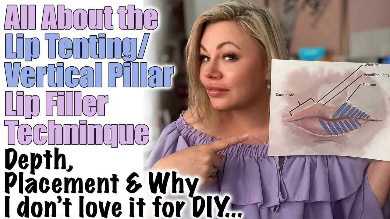 All About Lip Tenting/ Vertical Pillar Lip Filler Technique: Depth ...