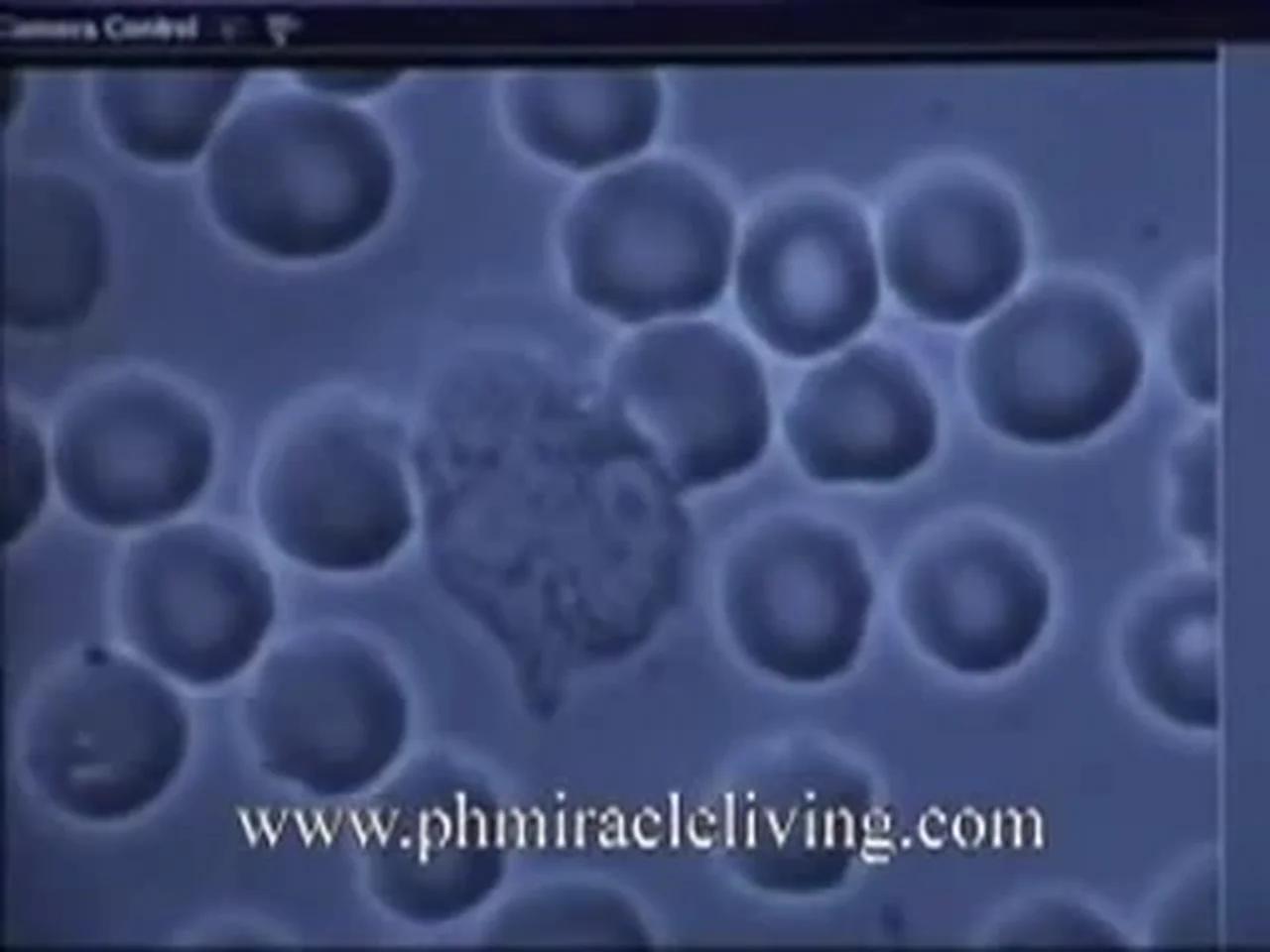 Live Blood Cell Analysis Dr. Robert Young